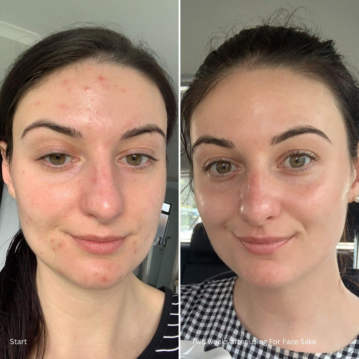 Boring Without You Bundle | Combination Skin